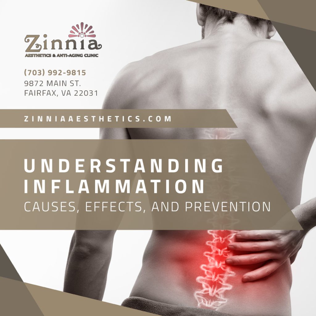 Understanding Inflammation: Causes, Effects, and Prevention | Zinnia ...